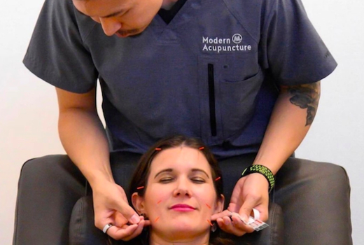 $39 For A 30-Minute Acupuncture Session, SoHo (a $100 value) | Modern ...